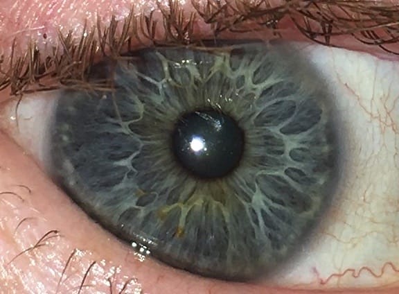 The Intuitive Eye - Irigenics